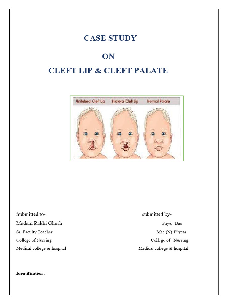Case Study On Cleft Lip, Cleft Palate | PDF | Surgery | Breastfeeding