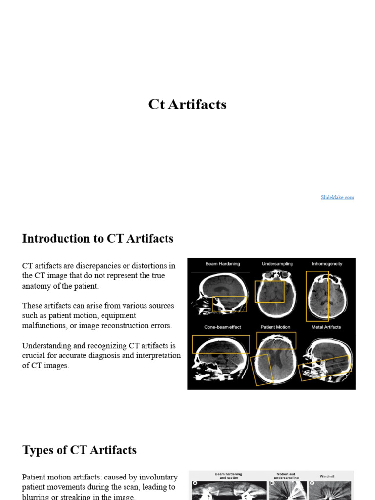 CT Artifacts | PDF | Ct Scan | Radiology