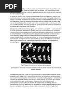 Tipping y Torque en Ortodoncia | PDF | Especialidades Medicas | Ramas ...