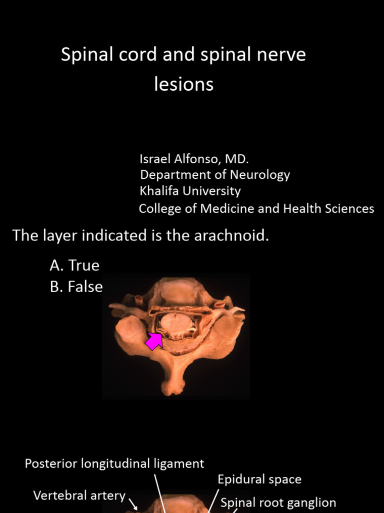 Selected Frames - Spinal Cord and Spinal Nerve Lesions | PDF | Spinal ...