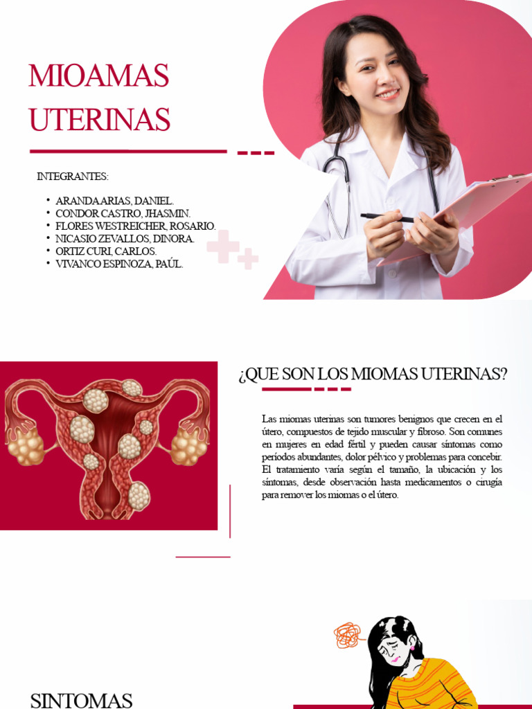 MIOMAS UTERINAS | Descargar gratis PDF | Útero | Fertilidad