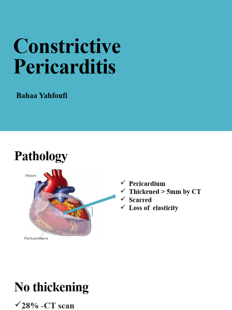 Constrictivepericarditis Inprocess 140508025746 Phpapp01 | PDF | Diastole | Ventricle (Heart)
