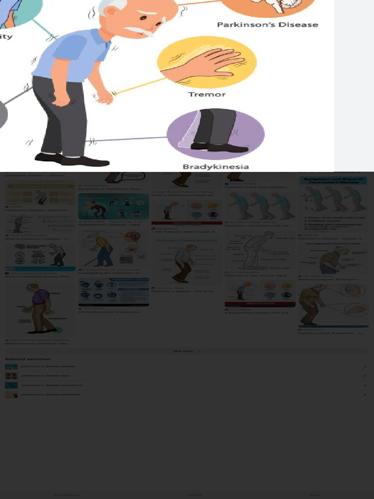 Searchq Parkinson&Sca Esv 590391945&Rlz 1C9BKJA EnMX1024MX1024&Hl en-US ...