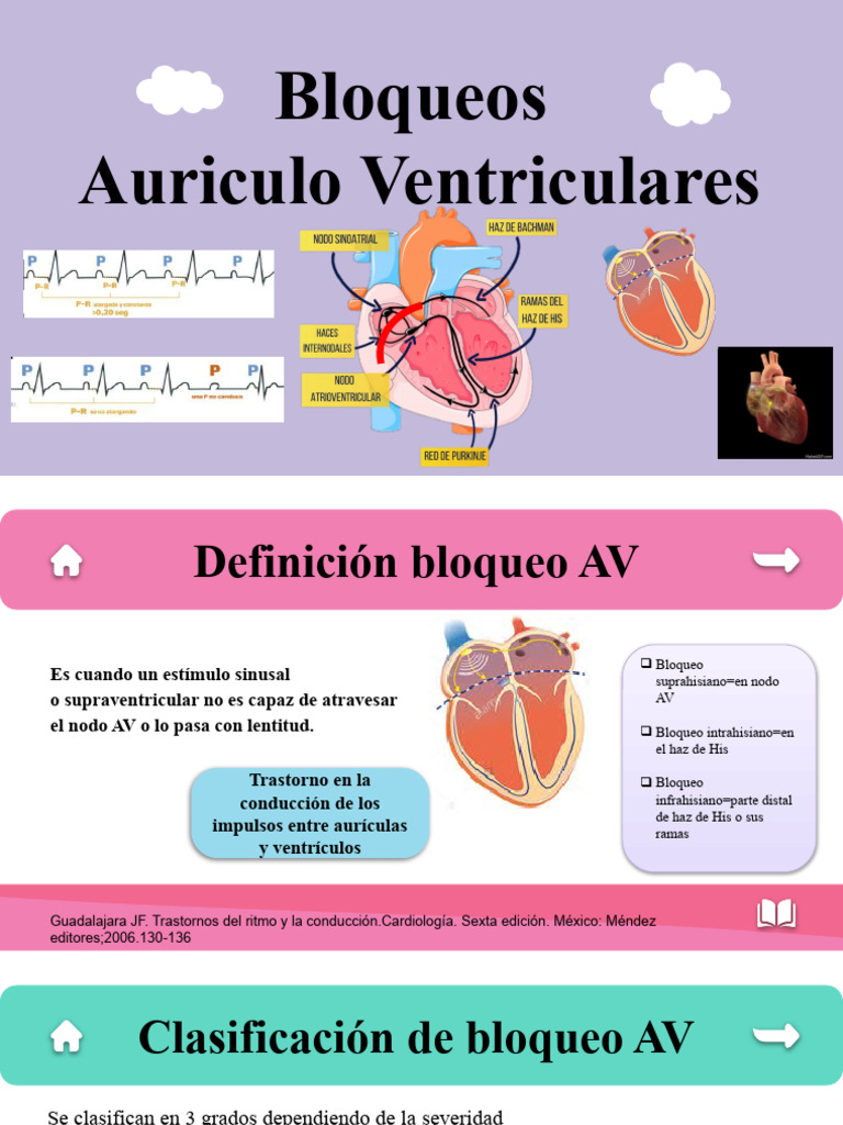 Bloqueo AV Definicion y Cuadro Clinico | PDF | Electrocardiografia | Cardiología