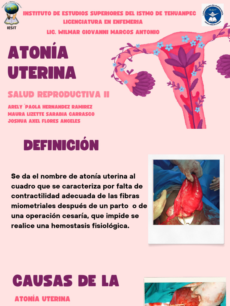 ATONÍA UTERINA | Descargar gratis PDF | Parto | Útero