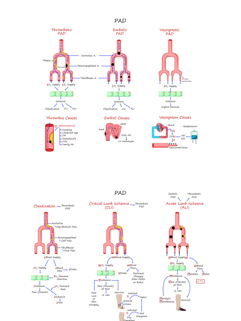13 - Peripheral Arterial Disease (Illustrations Key) | PDF | Ischemia ...