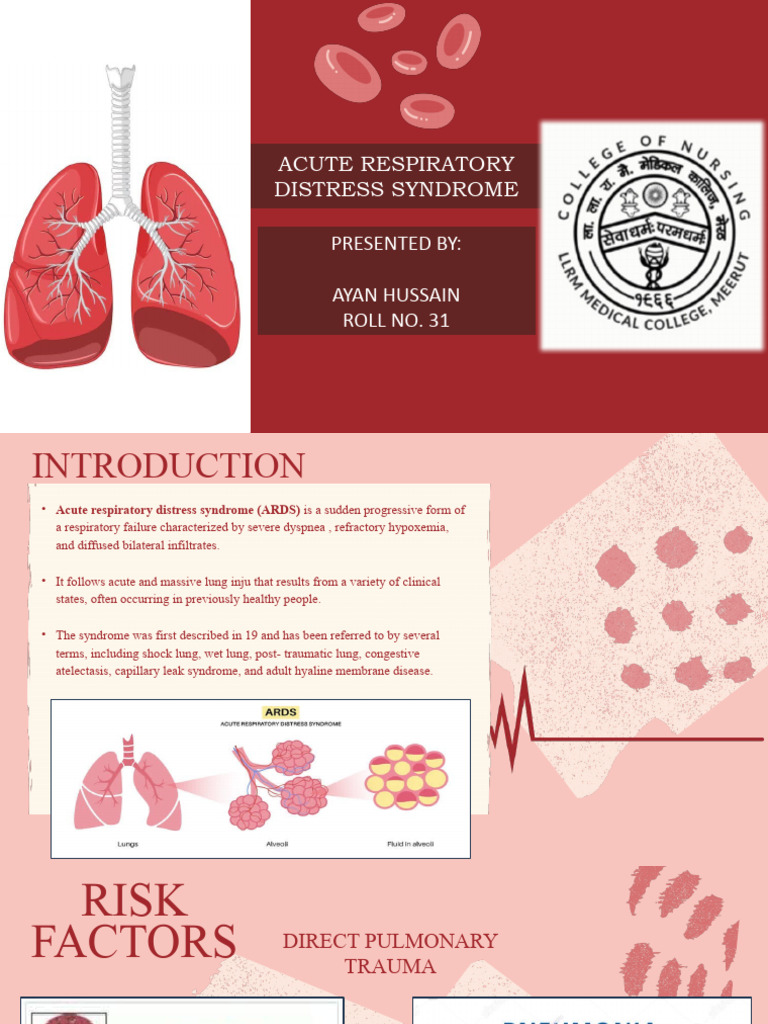 Understanding Acute Respiratory Distress Syndrome | PDF | Lung ...