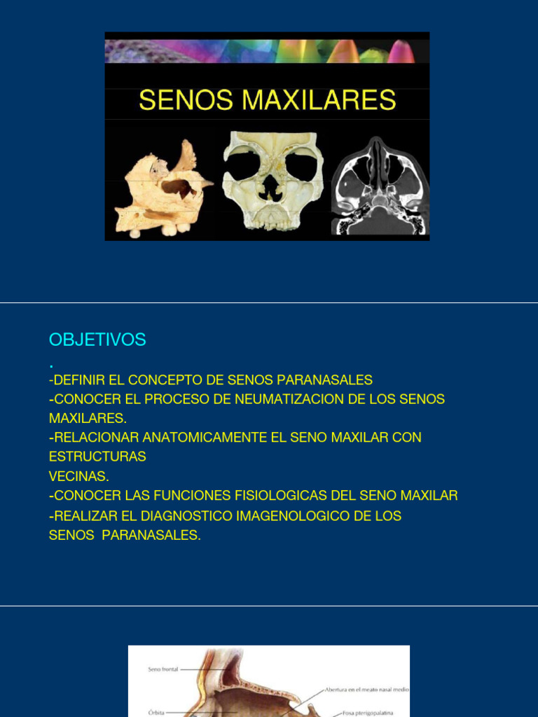 Anatomía y Funciones del Seno Maxilar | PDF | Cabeza y cuello humanos ...