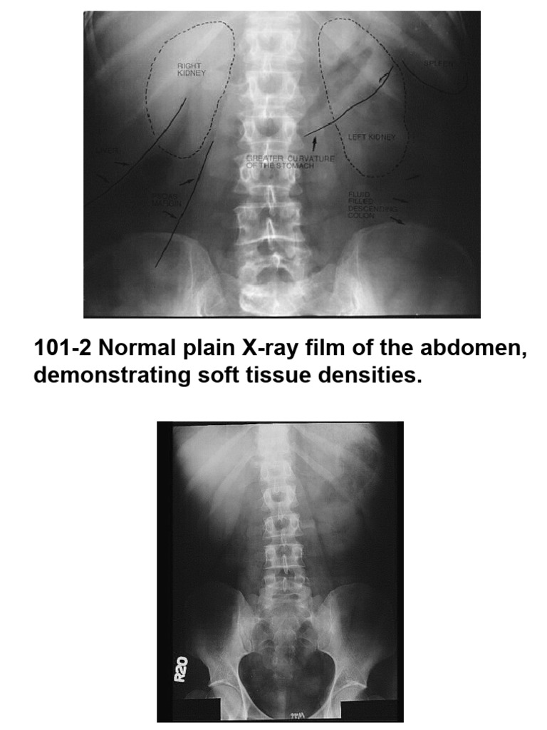 Imaging in Surgery (The Normal) | PDF | Gastrointestinal Tract | Liver