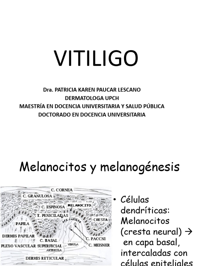 VITILIGO (1) | PDF | Piel | Especialidades Medicas