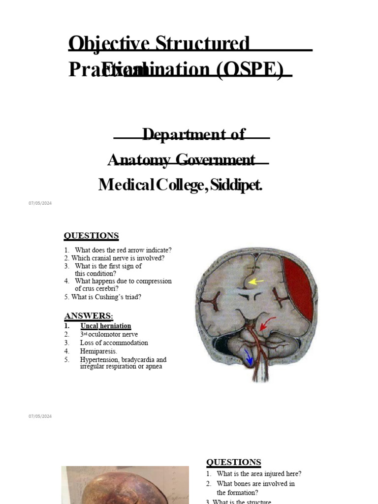 Ospe Head & Neck | PDF | Human Nose | Cerebrospinal Fluid