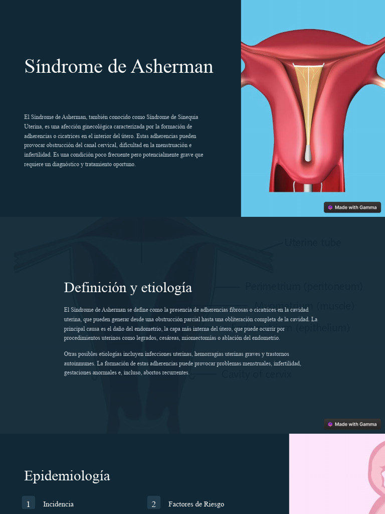 Sindrome de Asherman | PDF | Especialidades Medicas | Reproducción humana