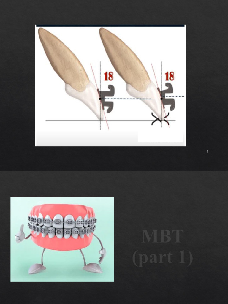 MBT Final Part 1 (1) (Autosaved) | PDF | Orthodontics | Mouth