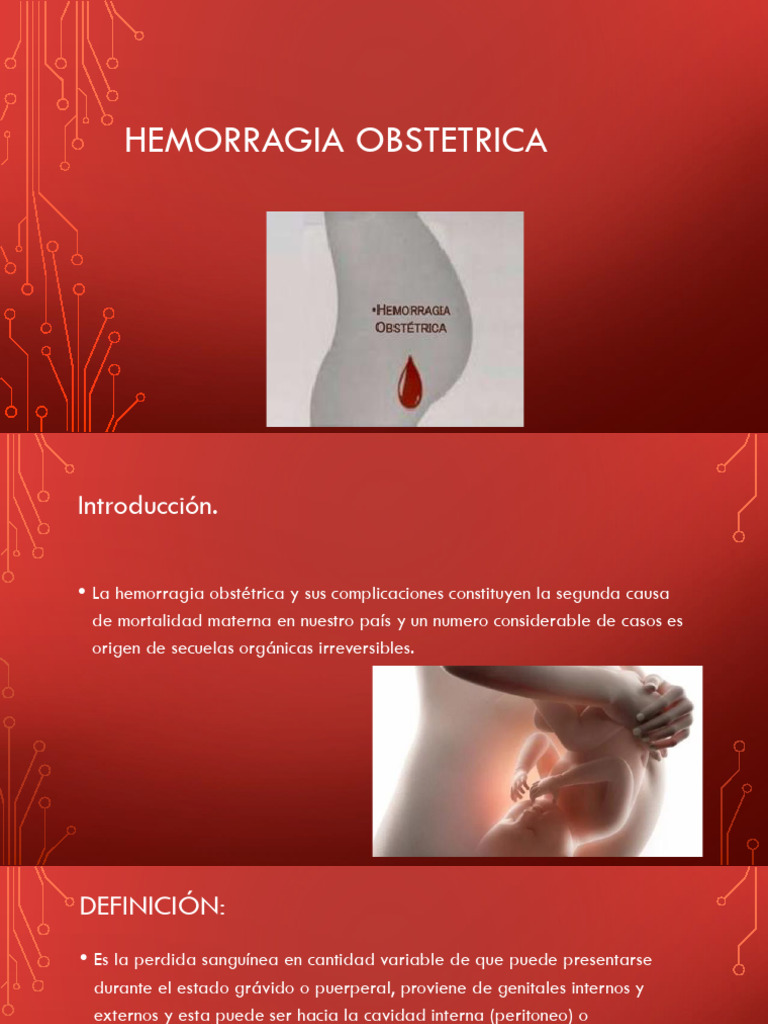 Hemorragia Obstetrica | PDF | Parto | El embarazo