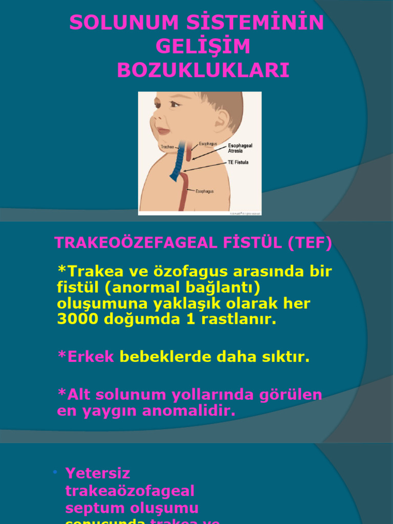 SINIF 2. KURUL Solunum Sisteminin Embriyolojik Gelişimi Ve Gelişim Bozuklukları2-2022 | PDF