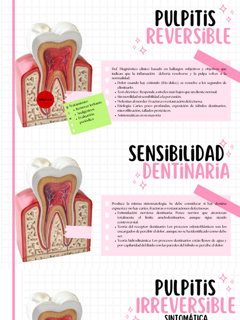 Diagnóstico y Tratamiento de Pulpitis | PDF | Enfermedades y trastornos | Medicina CLINICA