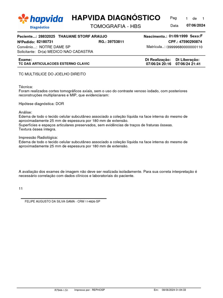 Hapvida Diagnóstico: Tomografia - Hbs | PDF