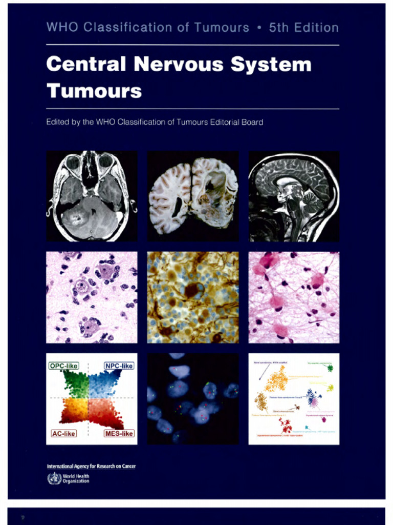 Central Nervous System Tumours 5ed WHO Classification of Tumours | PDF