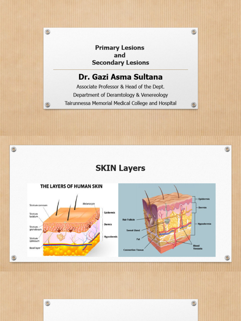 Lecture 1 (Basics) | PDF | Scar | Epidermis