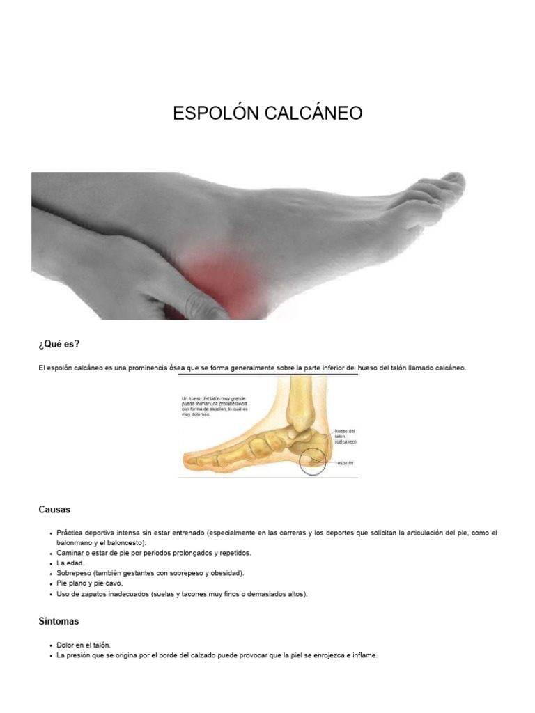 ESPOLÓN CALCANEO | Descargar gratis PDF | Pie | Sistema musculoesquelético