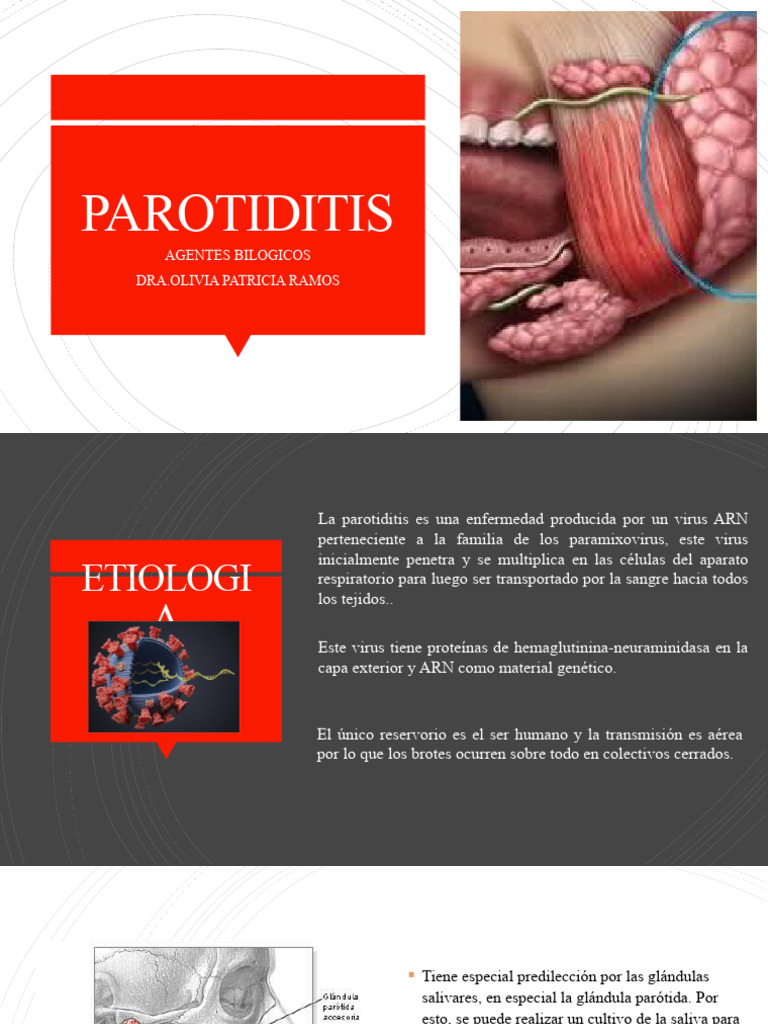 PAROTIDITIS | PDF | Microbiología | Enfermedades y trastornos