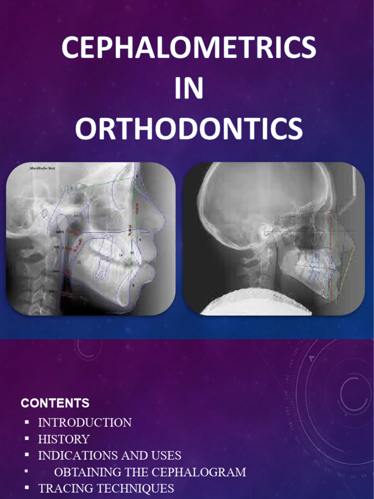 Cephalometrics in Orthodontics | PDF | Skull | Orthodontics