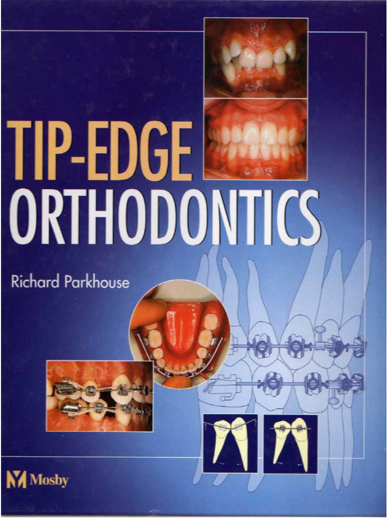 Richard Parkhouse - The Tip-Edge Orthodontic System (2003, Mosby ...