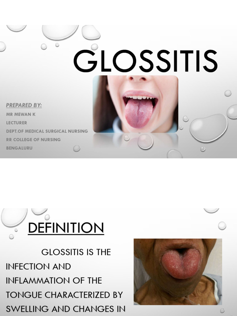 Glossitis | PDF