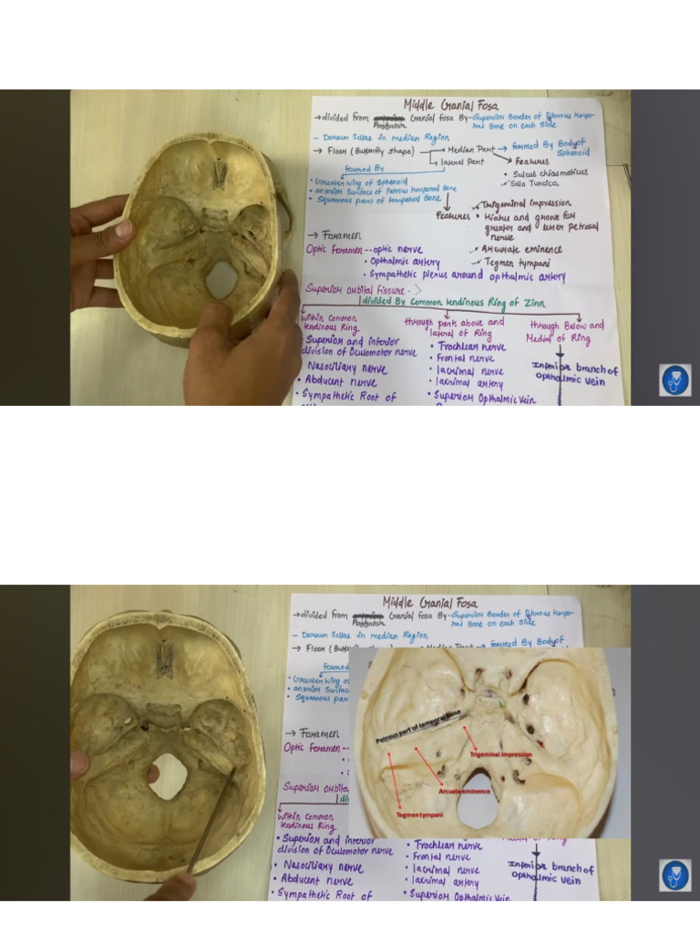 Middle Cranial Fossa | PDF