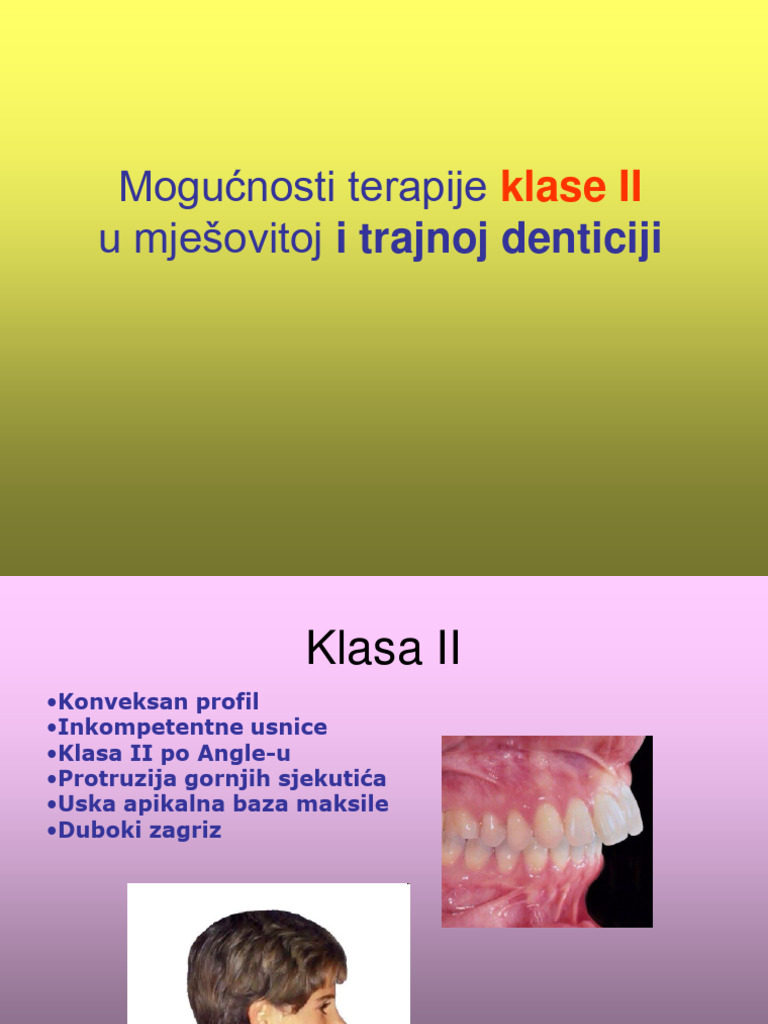 10 Terapija Anomalija Klase II | PDF