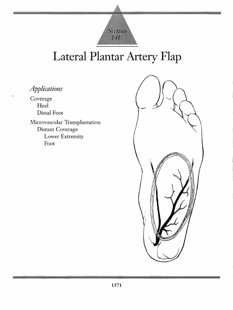 Mathes CH14 Lateral Plantar Artery Flap | PDF