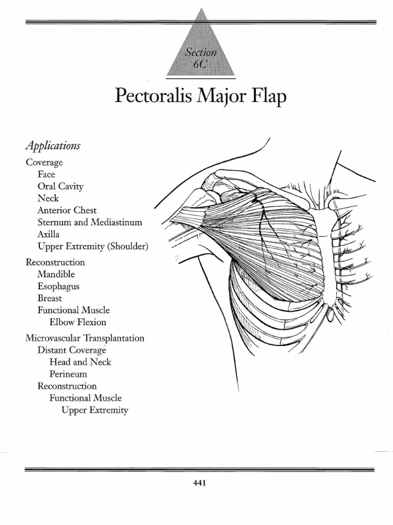 Mathes CH6 Pectoralis Major Flap | PDF