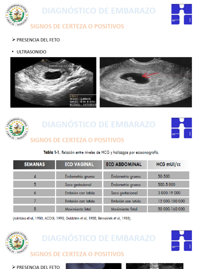 Diagnostico de embarazo | PDF