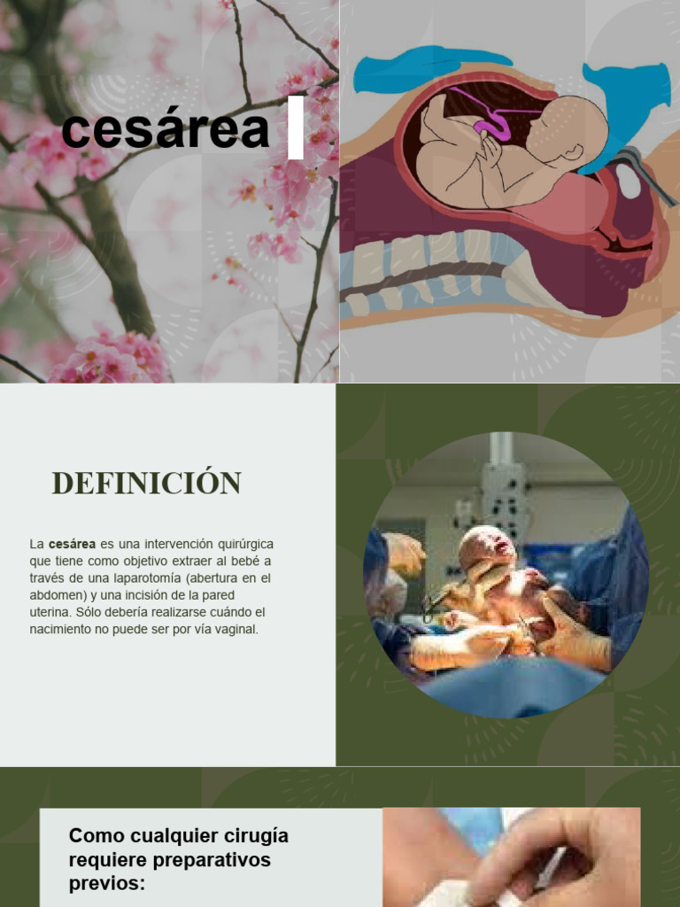 Cesárea | PDF | Parto | Seccion de cesárea