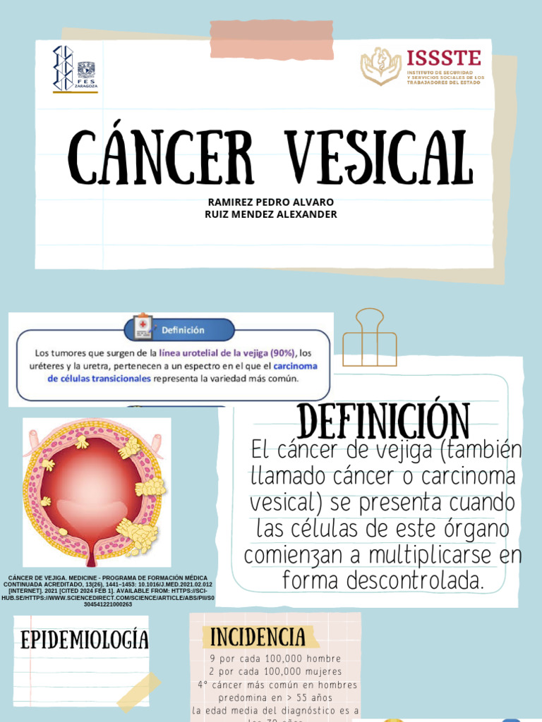 Cáncer Vesical | PDF | Cáncer | Neoplasias