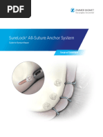 Acumed ES Surgical Technique Fibula Nail 2 ESFNA10 02 A | PDF