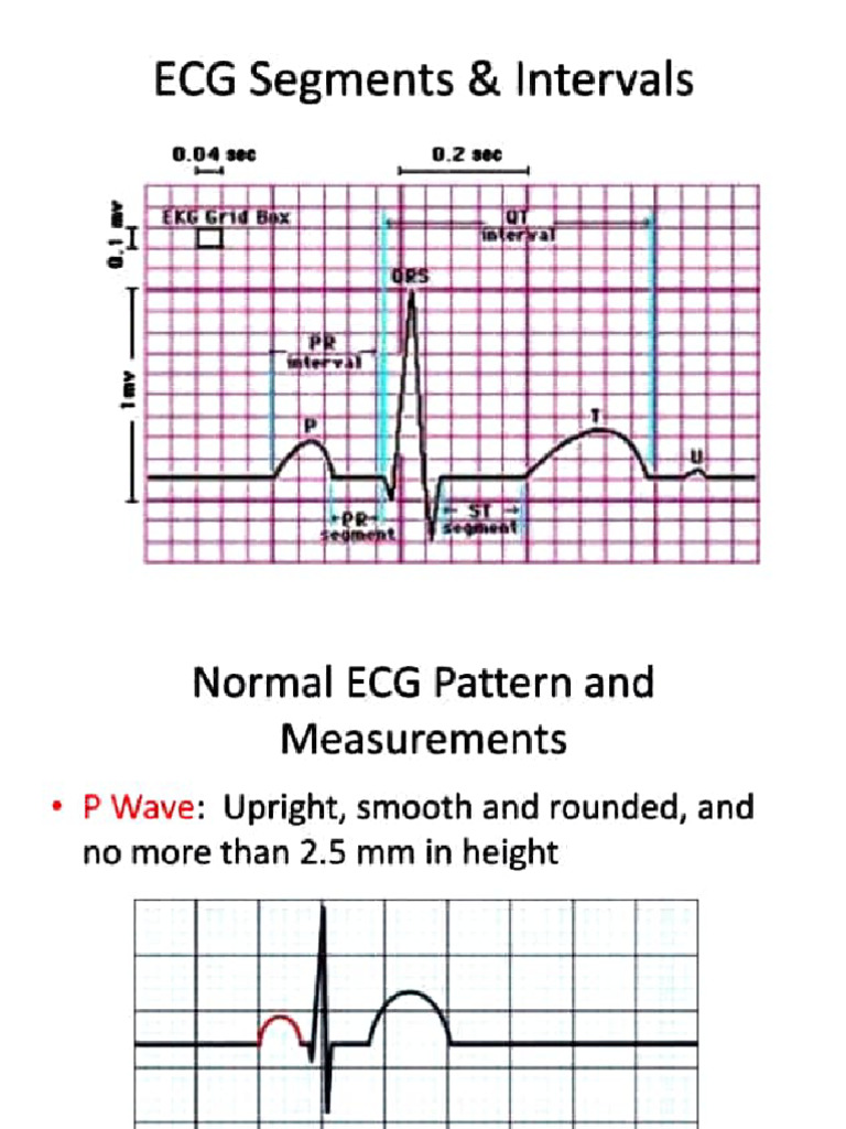 ECG Segments Intervals | PDF | Electrocardiography | Heart Rate