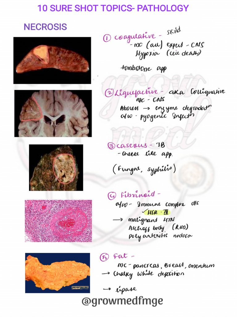 Pathology Sure Shot Topics | PDF