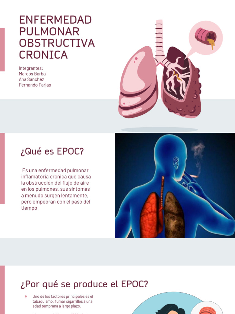 Guía Completa sobre EPOC y Tratamientos | PDF | Enfermedad pulmonar ...