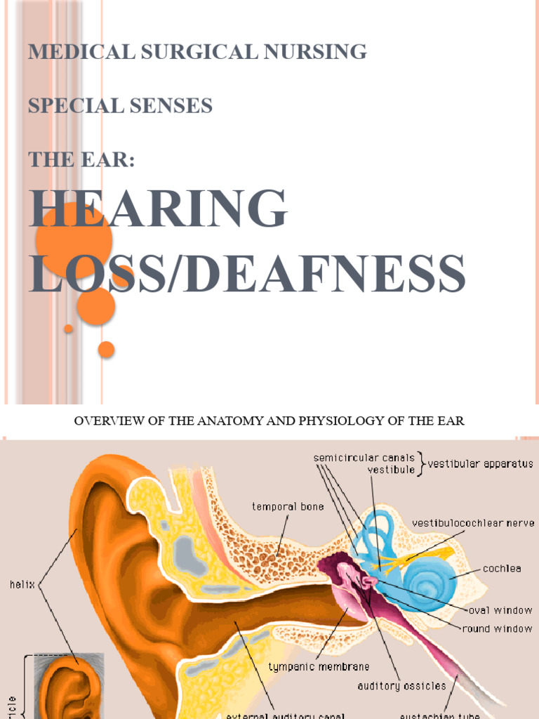 Tutorial on Hearing Loss | PDF | Hearing Loss | Ear