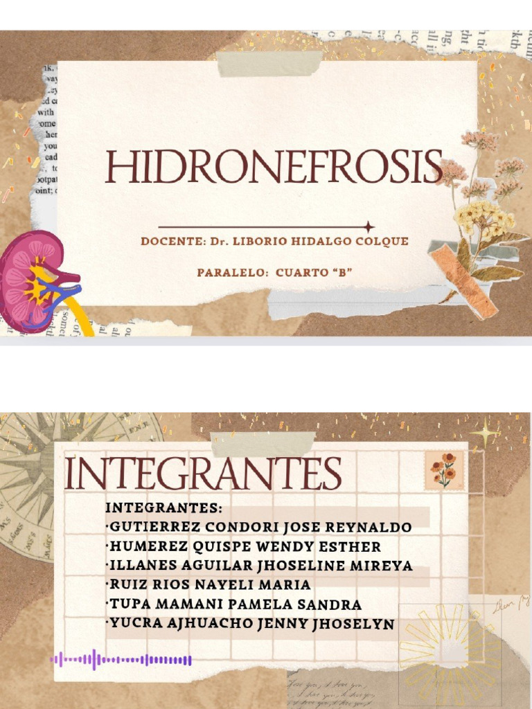 Hi Drone Fro Sis | PDF