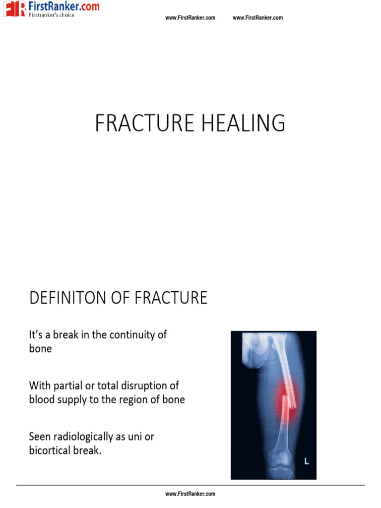 ORTHO Fracture Healing Notes | Download Free PDF | Bone ...
