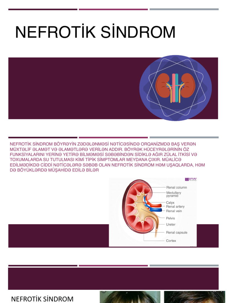 Share 'Nefrotik - PPTX' | PDF