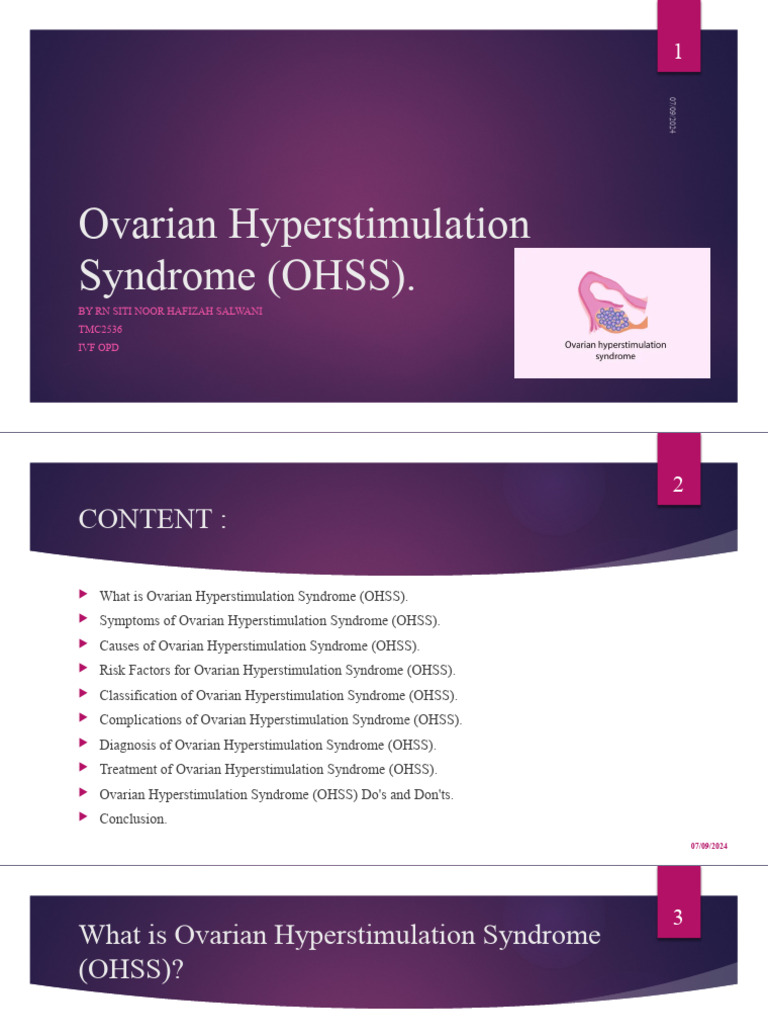 Ovarian Hyperstimulation Syndrome (OHSS) | PDF | Ovary | Clinical Medicine