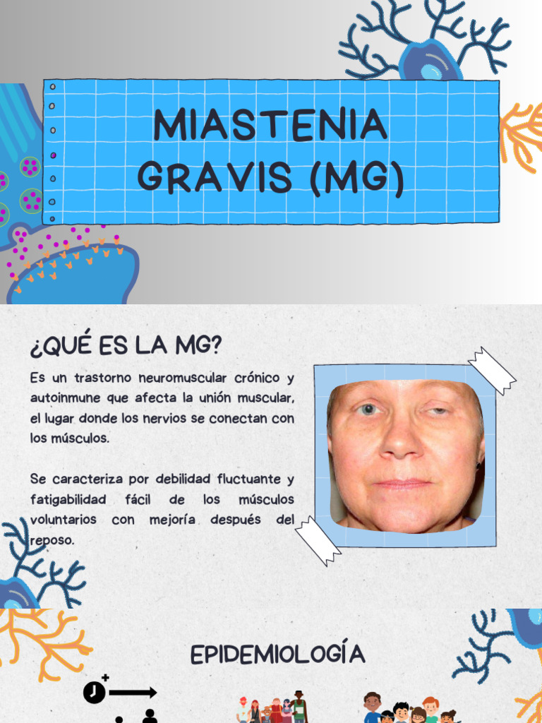 Miastenia Gravis | PDF | Unión neuromuscular | Especialidades Medicas Miastenia Gravis | PDF | Unión neuromuscular | Especialidades Medicas