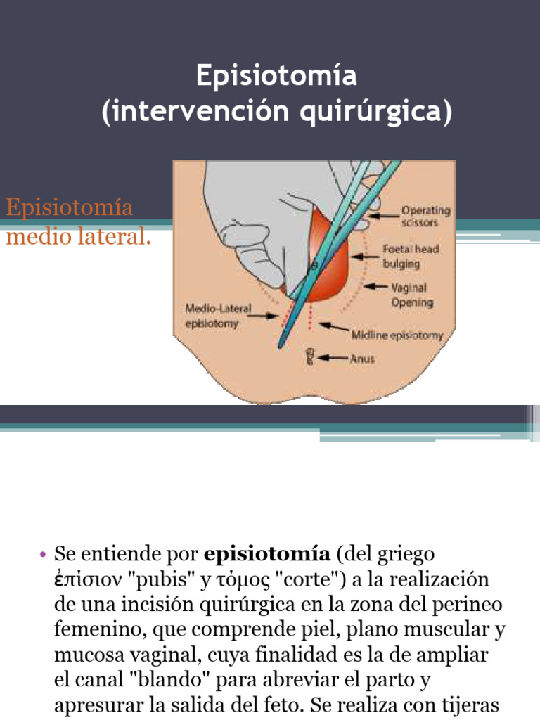 Episiotomia | PDF | Especialidades Medicas | Medicina CLINICA