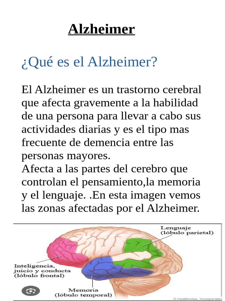 Causas y síntomas del Alzheimer | PDF | Enfermedad de Alzheimer | Demencia