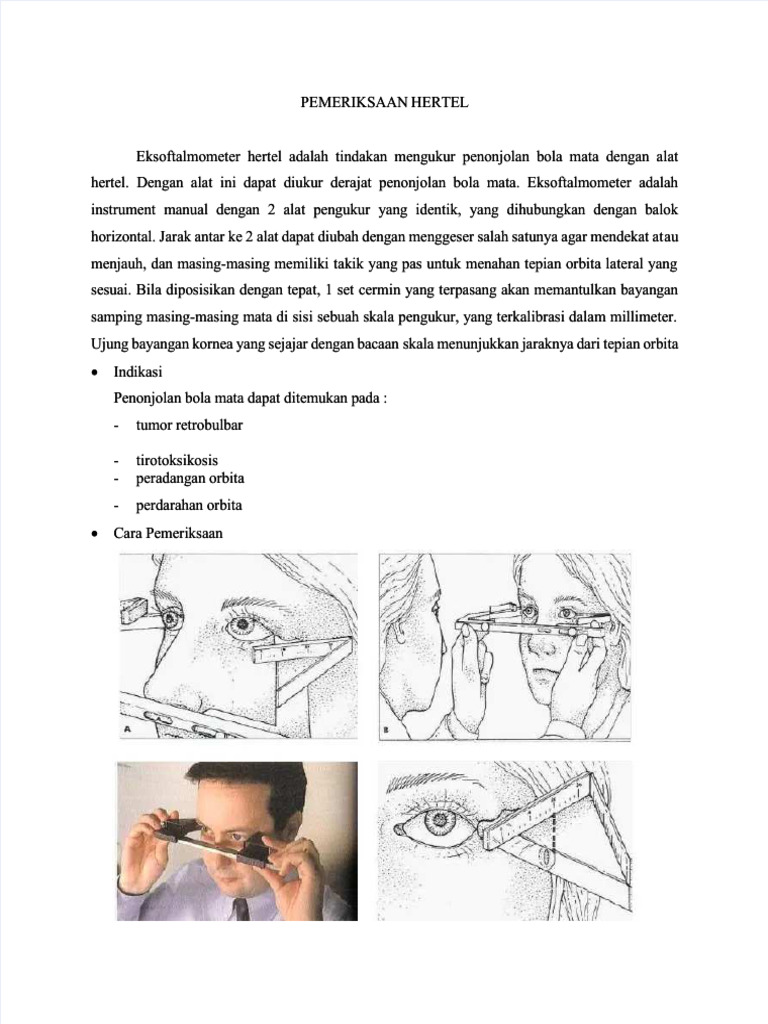 Eksoftalmometer Hertel: Cara dan Indikasi | PDF