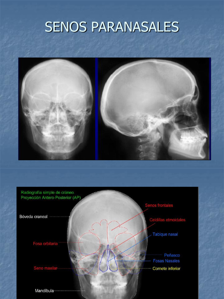 Anatomía Radiológica de Senos Paranasales | PDF | Ciencia y matemáticas