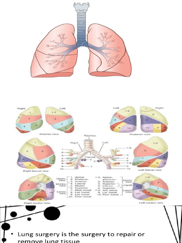 Pulmonary Surgery | PDF
